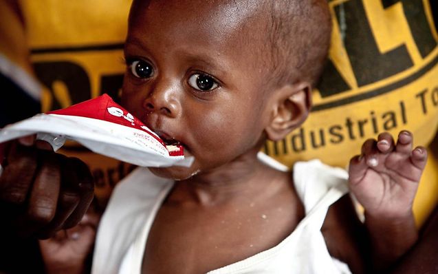Hunger in Afrika: Hungernde Kinder in Afrika brauchen Hilfe | UNICEF